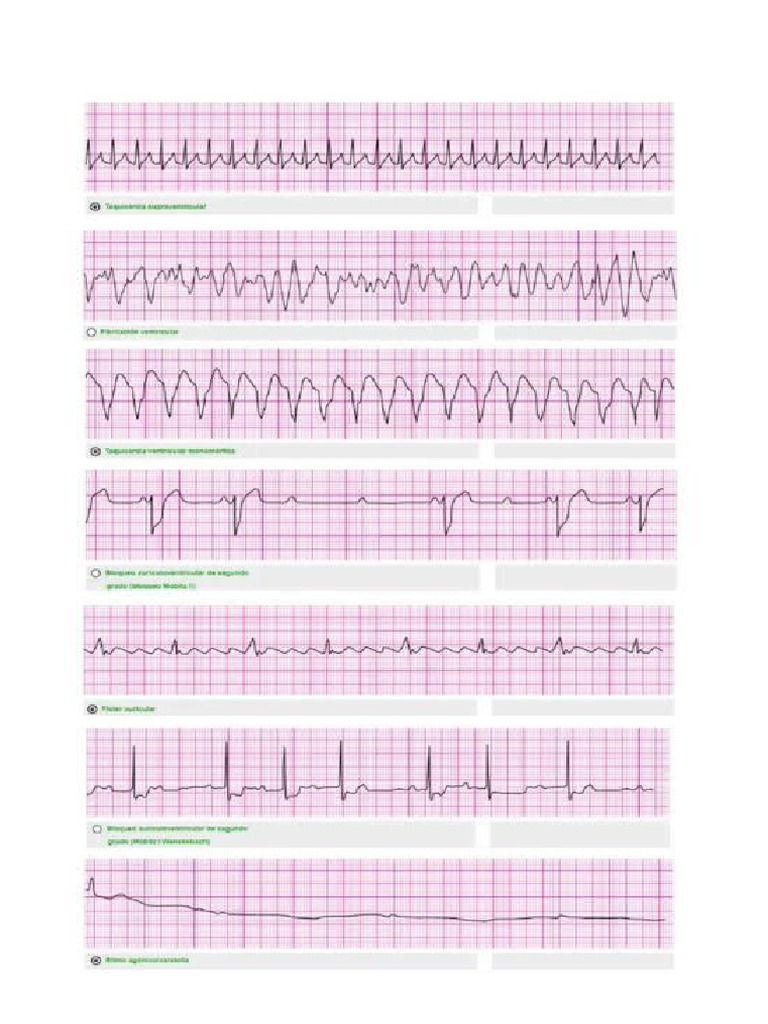 Acls | PDF