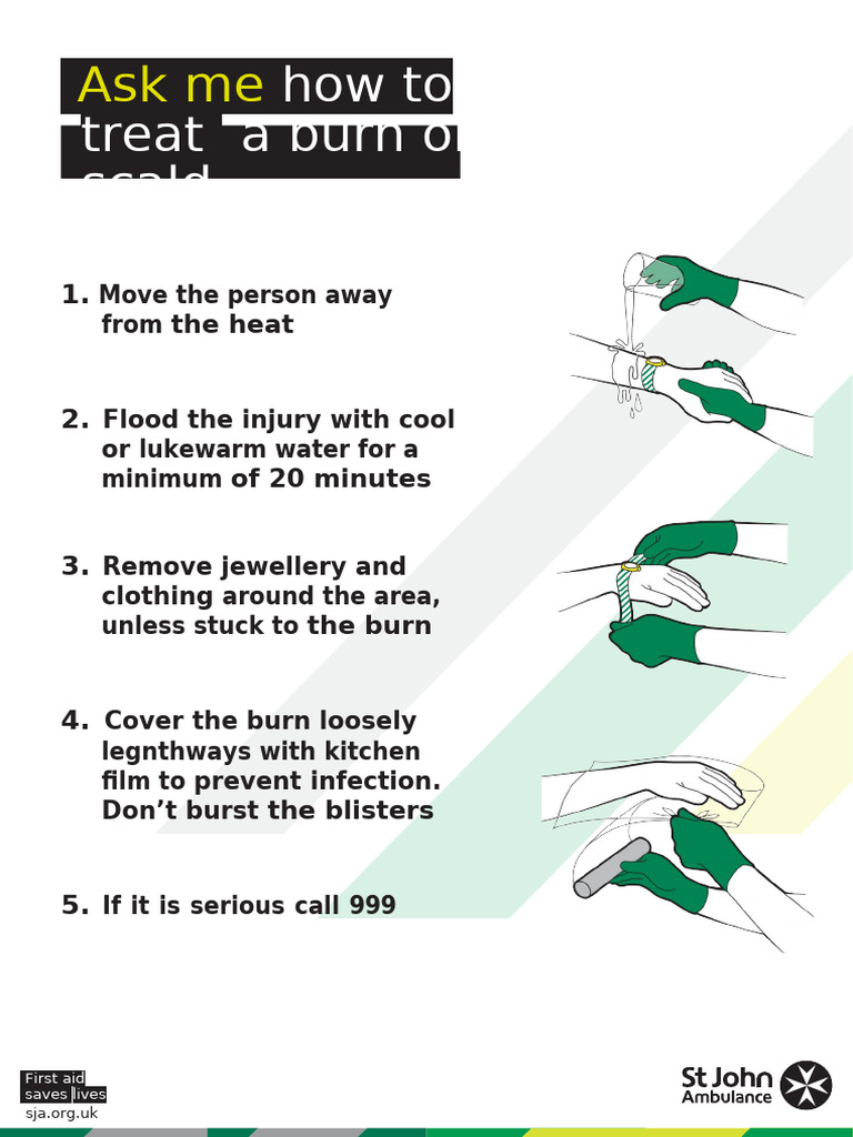 sja-burn-or-a-scald-poster | PDF