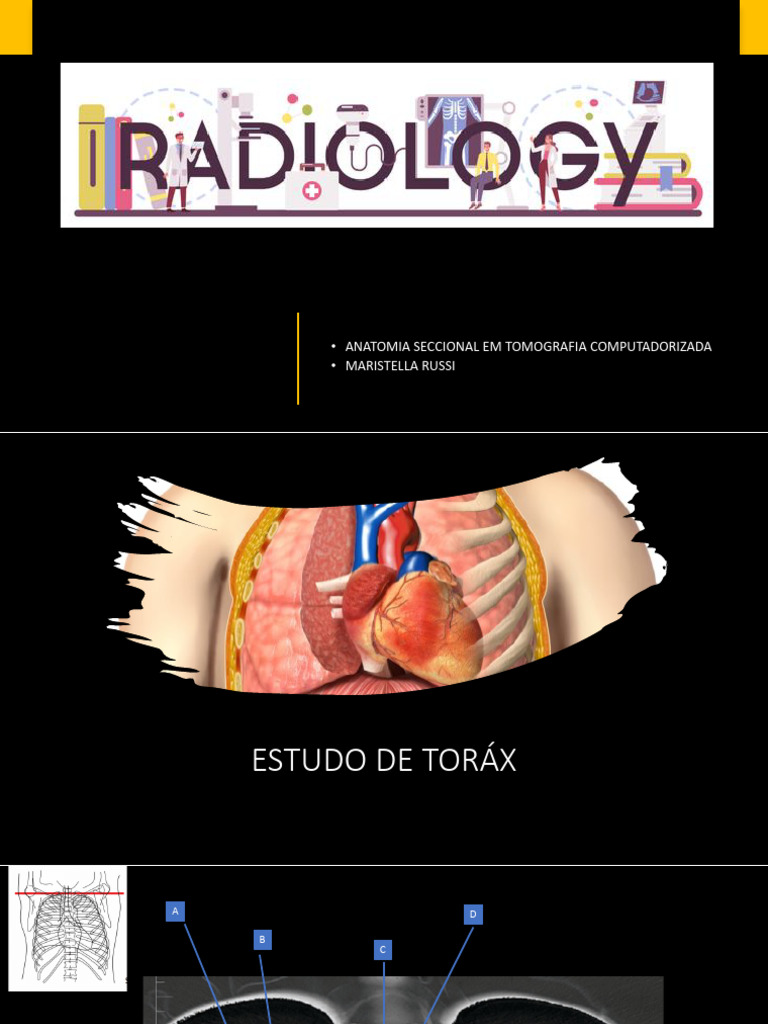 Anatomia Seccional em TC Torax | PDF | Rim | Átrio (coração)