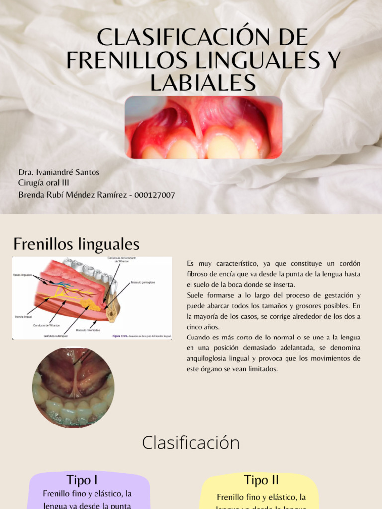 Clasificacion de Frenillos | PDF | Lengua | Boca