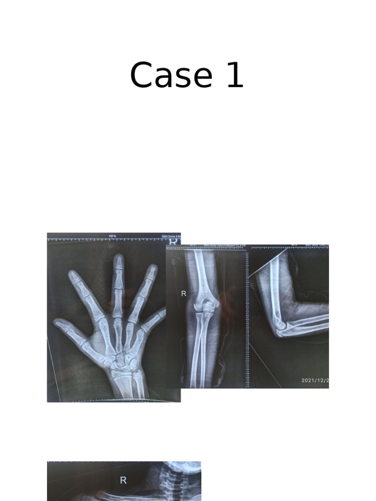X Ray Exercises b3f6f3d4 b9dd 4136 Adb6 65b5ec43ea15 | PDF