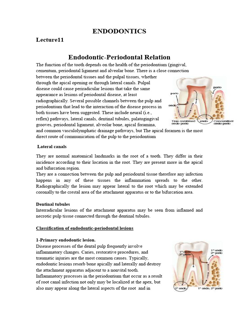 Endo perio lesion.pdf2 | PDF | Periodontology | Human Tooth