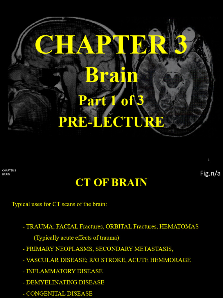 WEEK 5 Chapter 3 Brain PRE-LECTURE Slides | PDF | Magnetic Resonance Imaging | Ct Scan
