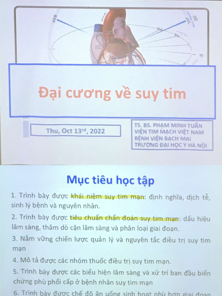 Suy tim Y4 | PDF