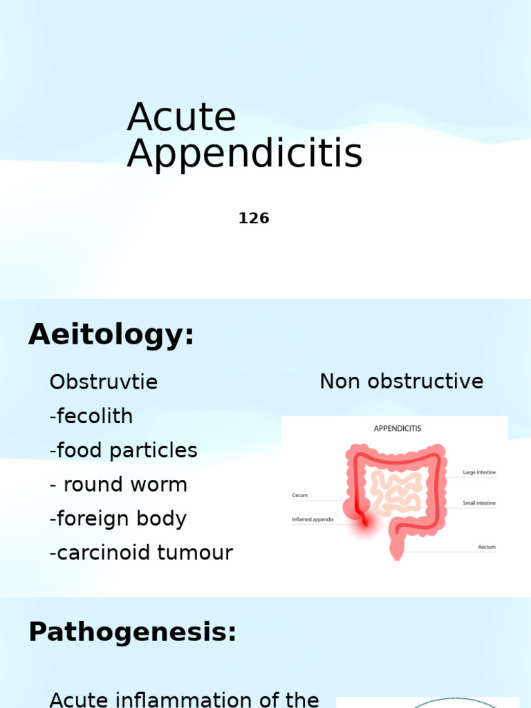Acute Appendicitis Overview and Signs | PDF