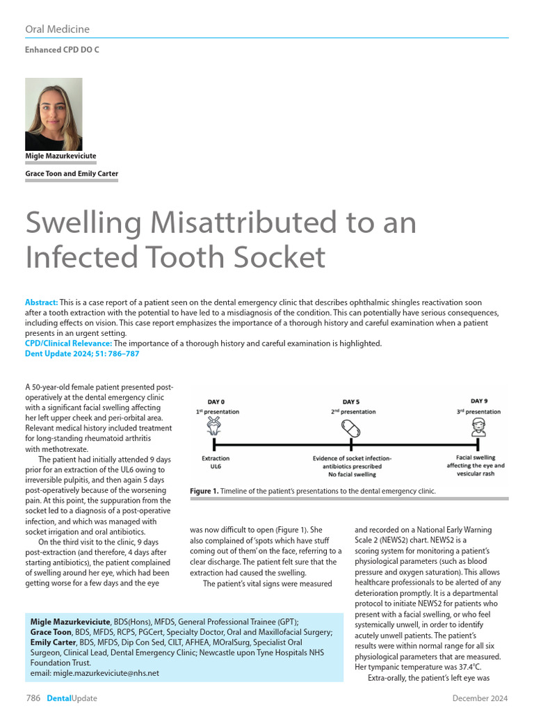 Swelling Misattributed to an Infected Tooth Socket | PDF | Diseases And ...