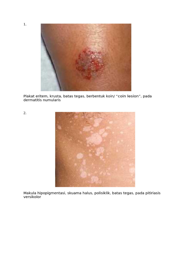 Contoh Kasus Skillab KIS 02 (Dosen) | PDF