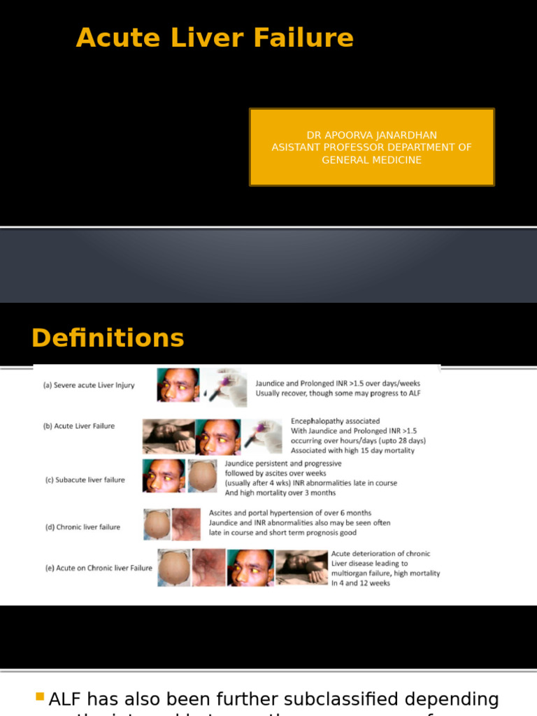 Acute Liver Failure Overview and Management | PDF | Hepatitis | Liver