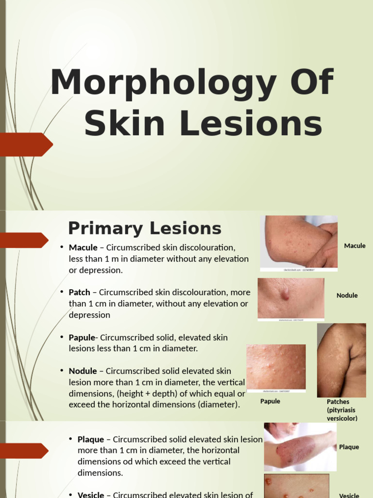 Morphology of Skin Lesions | PDF | Skin | Endocrine System