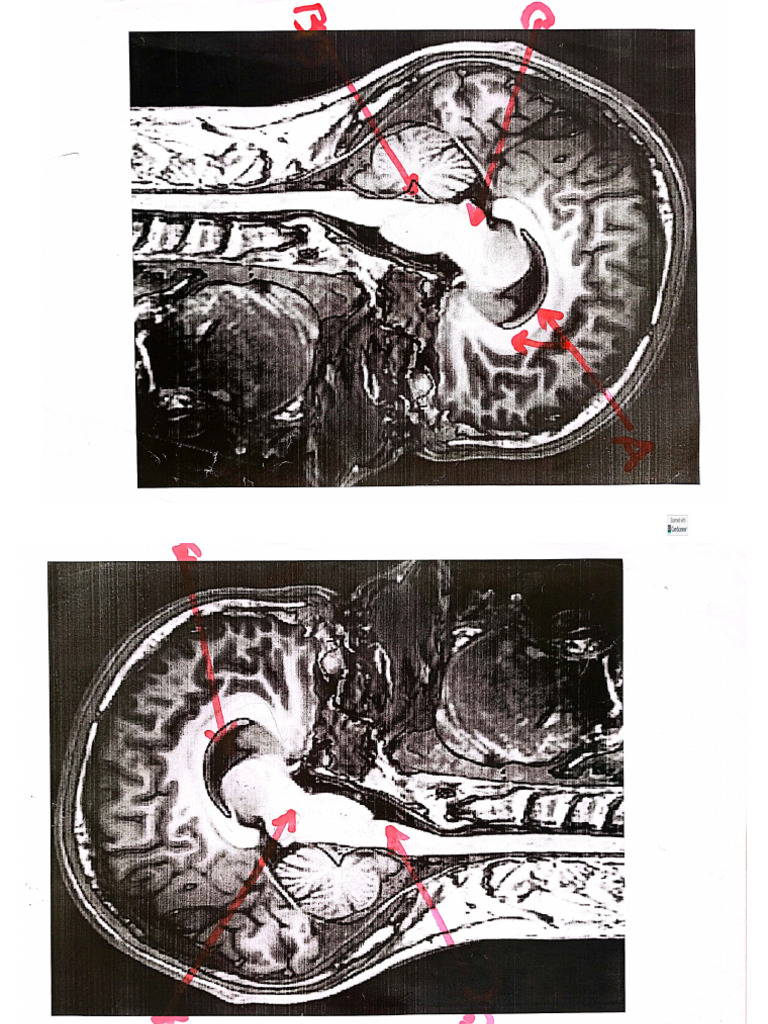 X-Ray CT Scan | PDF