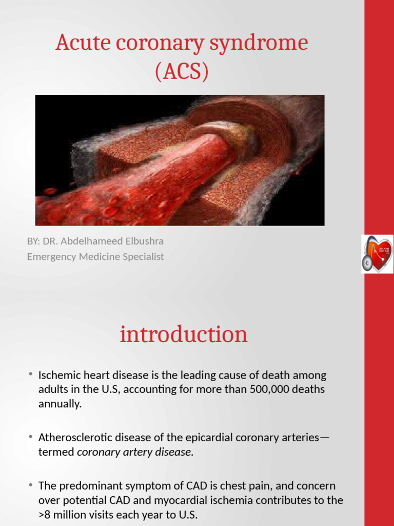 Acute Coronary Syndrome | PDF | Myocardial Infarction | Coronary ...
