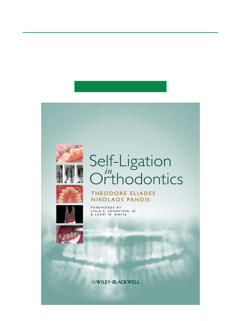 Self-Ligation in Orthodontics Guide | PDF