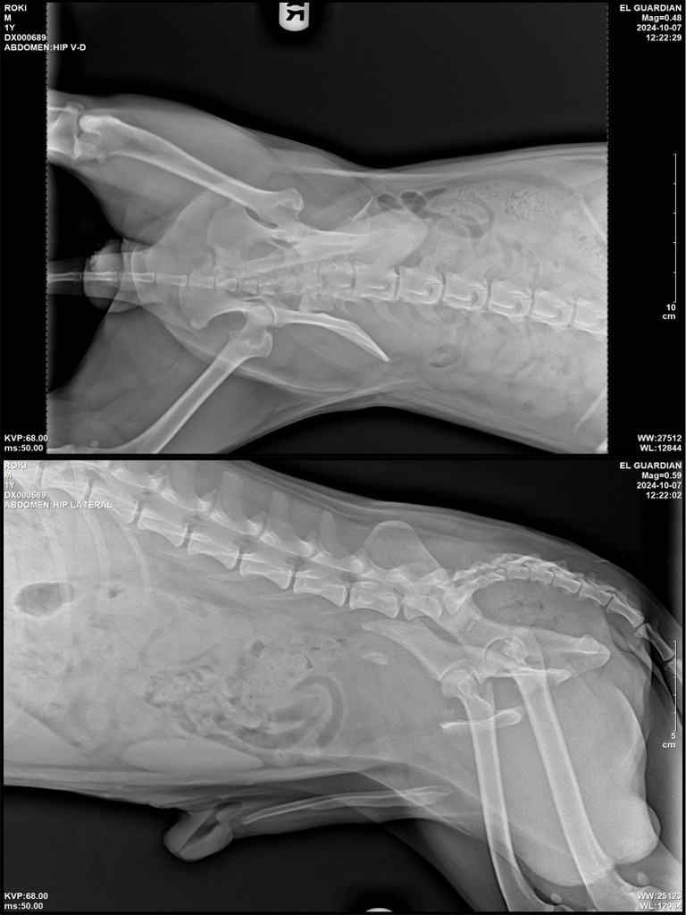 Rocki RX Cadera | PDF