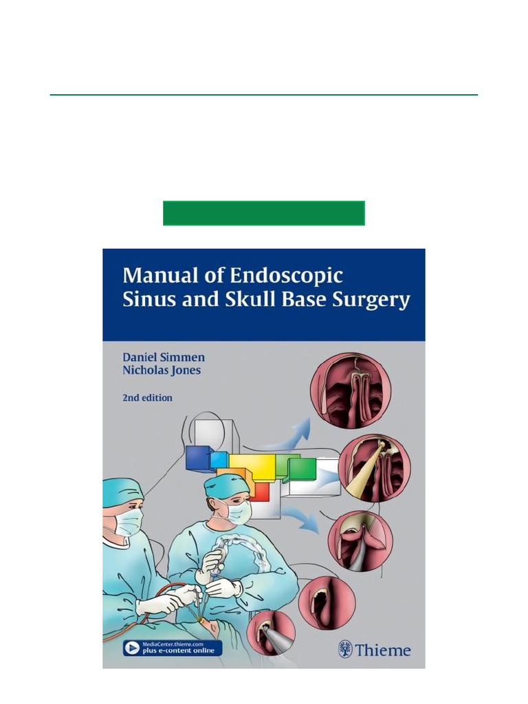 (Ebook PDF) Manual of Endoscopic Sinus and Skull Base Surgery 2nd Edition Unlimited Download | PDF