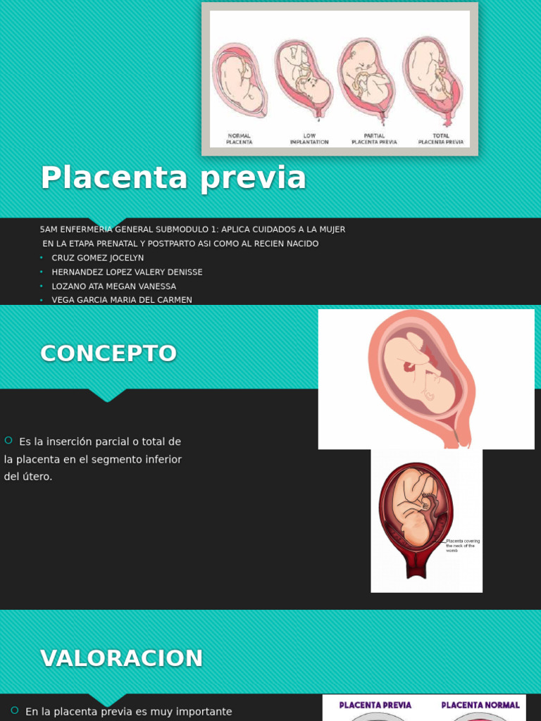 Placenta previa | PDF