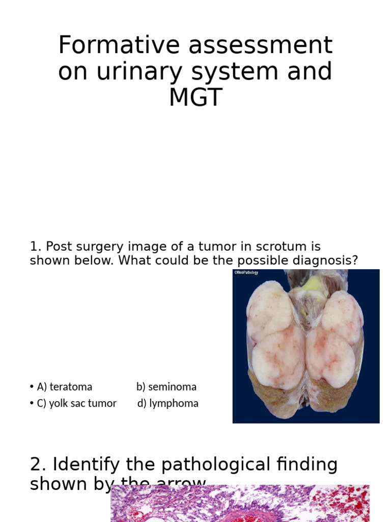 Formative Assessment On Urinary System and MGT | PDF | Kidney Disease ...