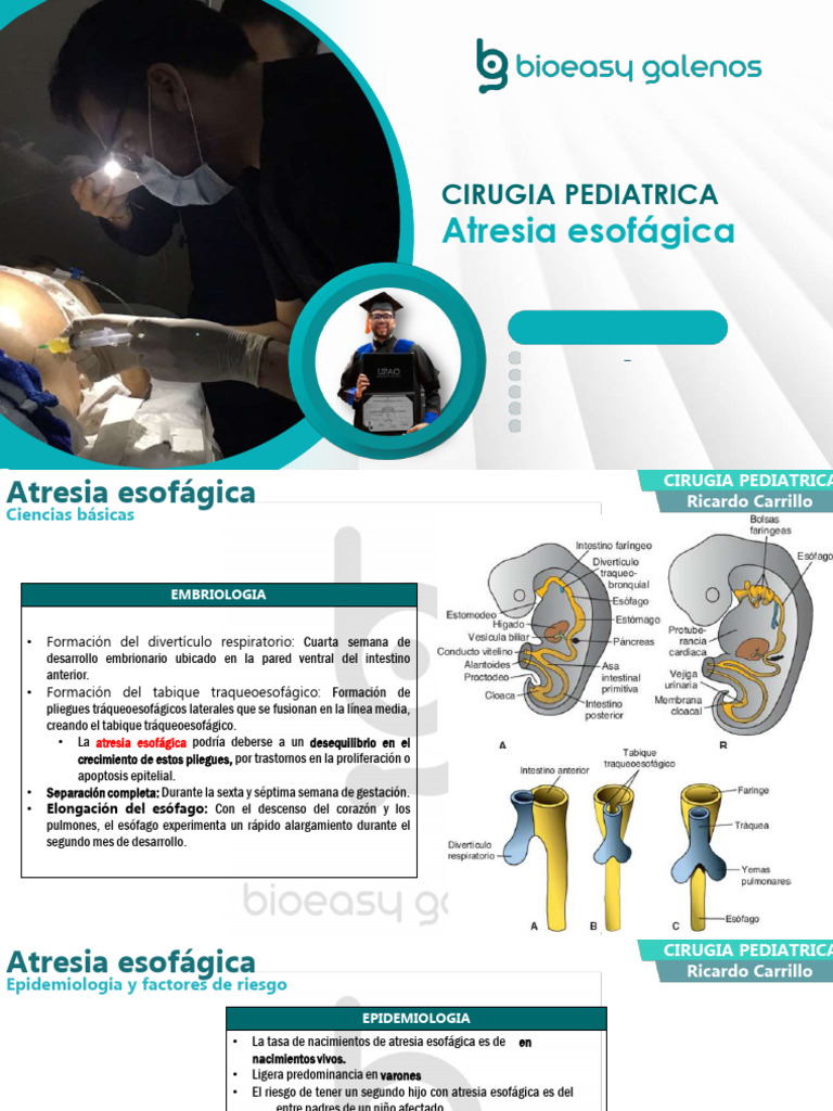 Atresia Esofágica: Diagnóstico y Tratamiento | PDF | Especialidades Medicas