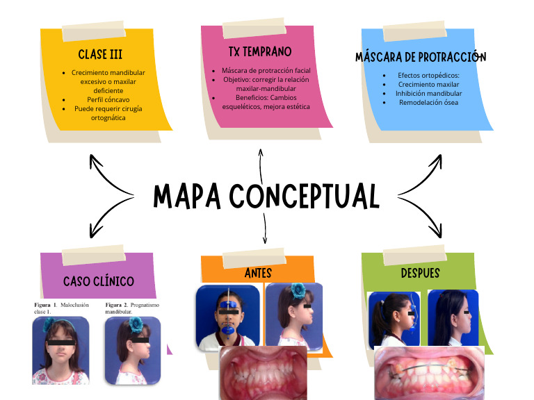 Tratamiento ortopédico de síndrome prognatico, con mascara de ...