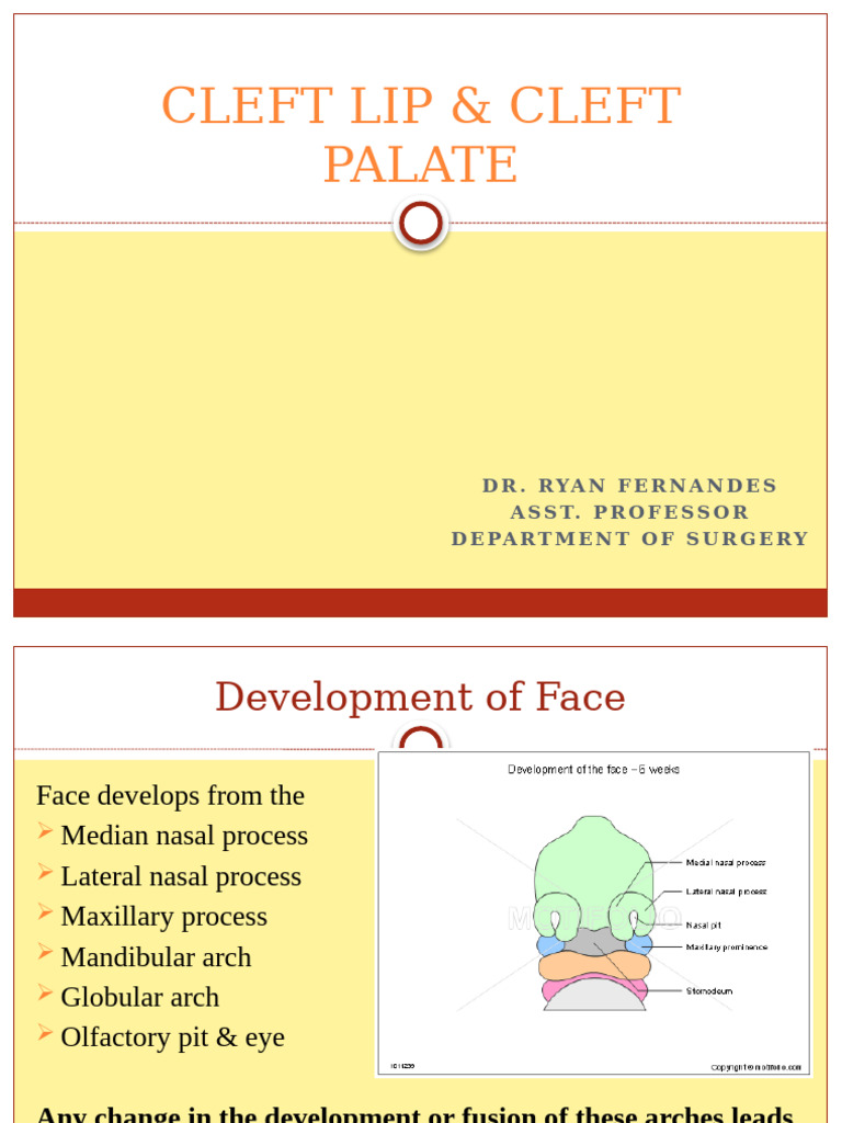 Cleft Lip A Palate | PDF | Human Nose | Human Head And Neck