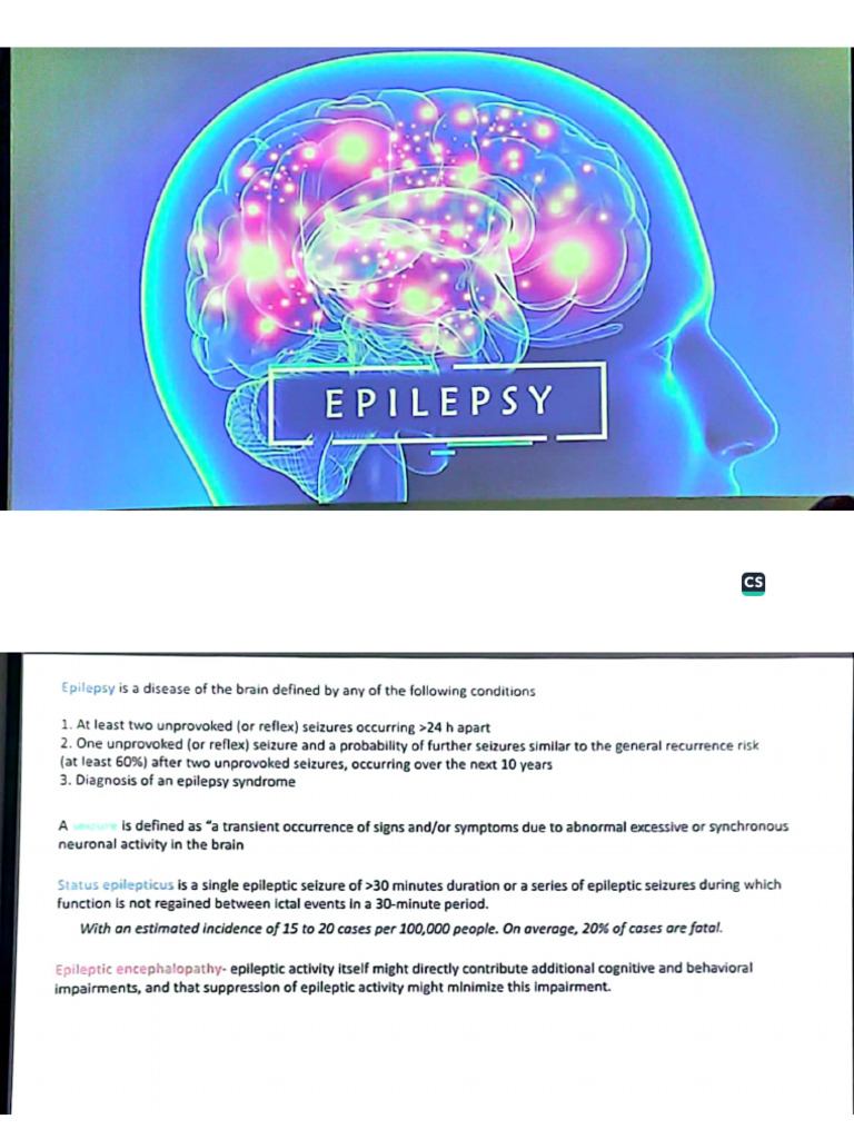 Epilepsy | PDF