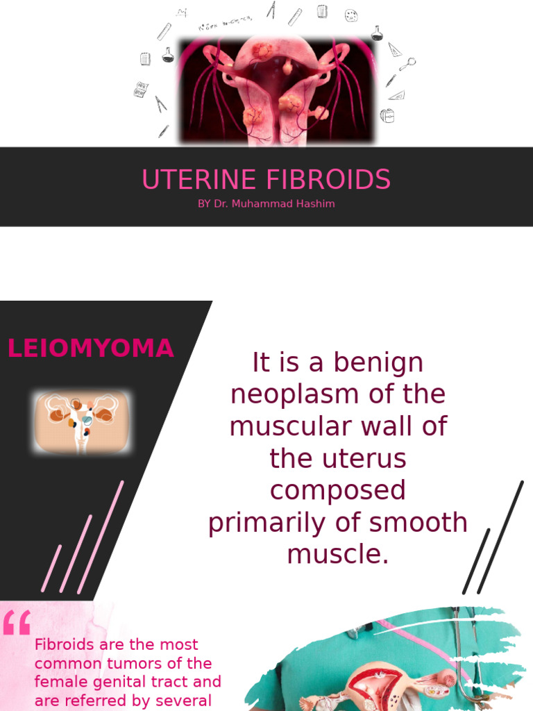 Fibroids 2 | PDF | Uterus | Medical Specialties