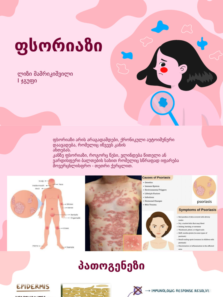 Fsoriazi Dermato | PDF