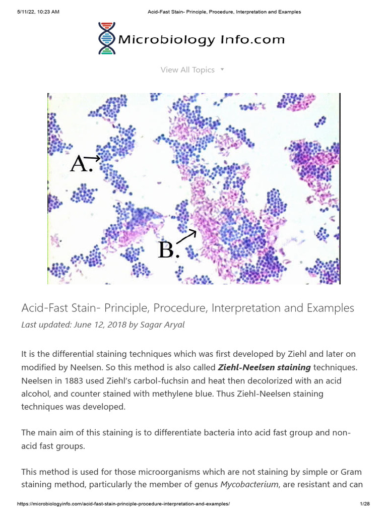 Acid-Fast Stain - Principle, Procedure, Interpretation and Examples ...