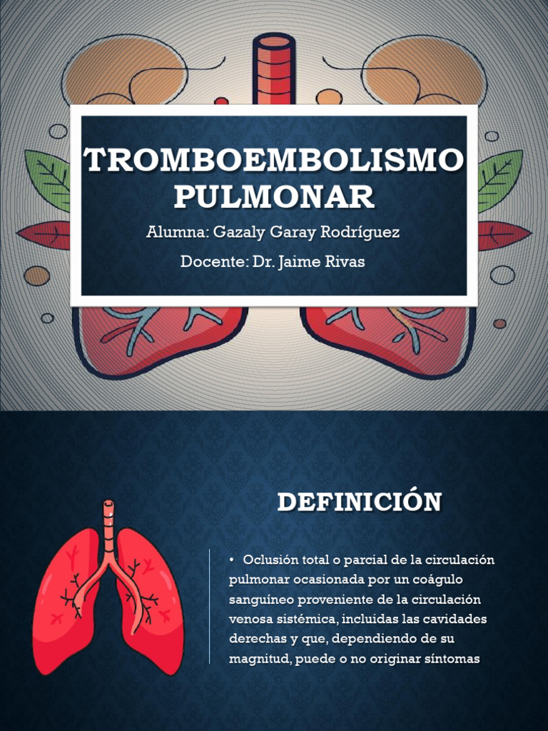 Tromboembolismo Pulmonar: Alumna: Gazaly Garay Rodríguez Docente: Dr ...