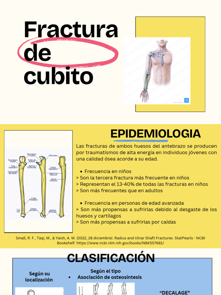 Fractura de cúbito: diagnóstico y tratamiento | PDF | Traumatologia | Codo