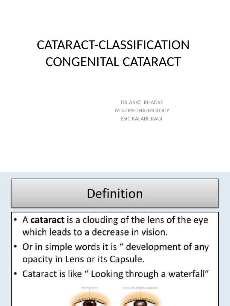Congenital Cataract | PDF
