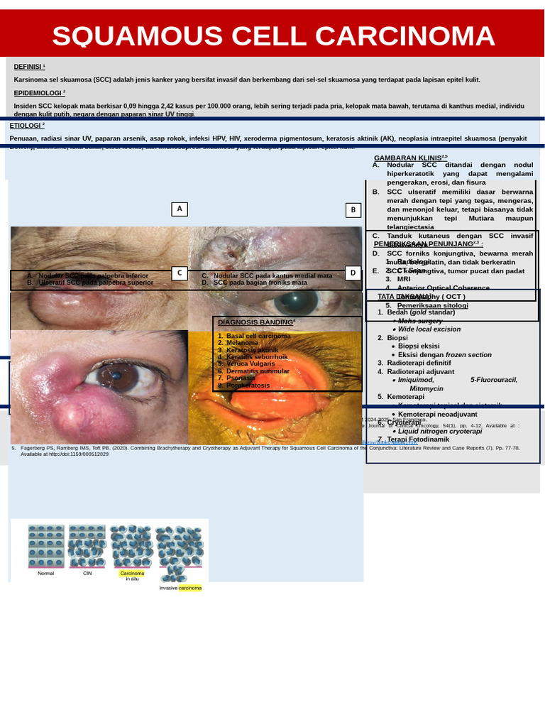 Poster SCC Sqqudah Di Edit | PDF