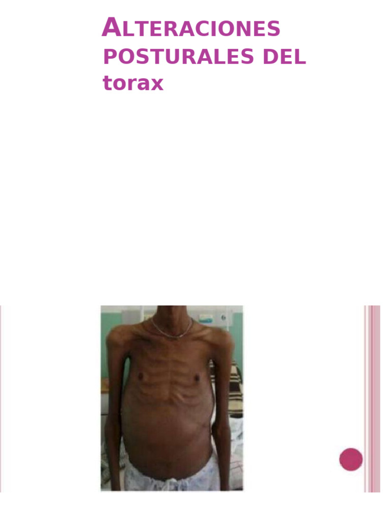 Alteraciones Del Torax | PDF