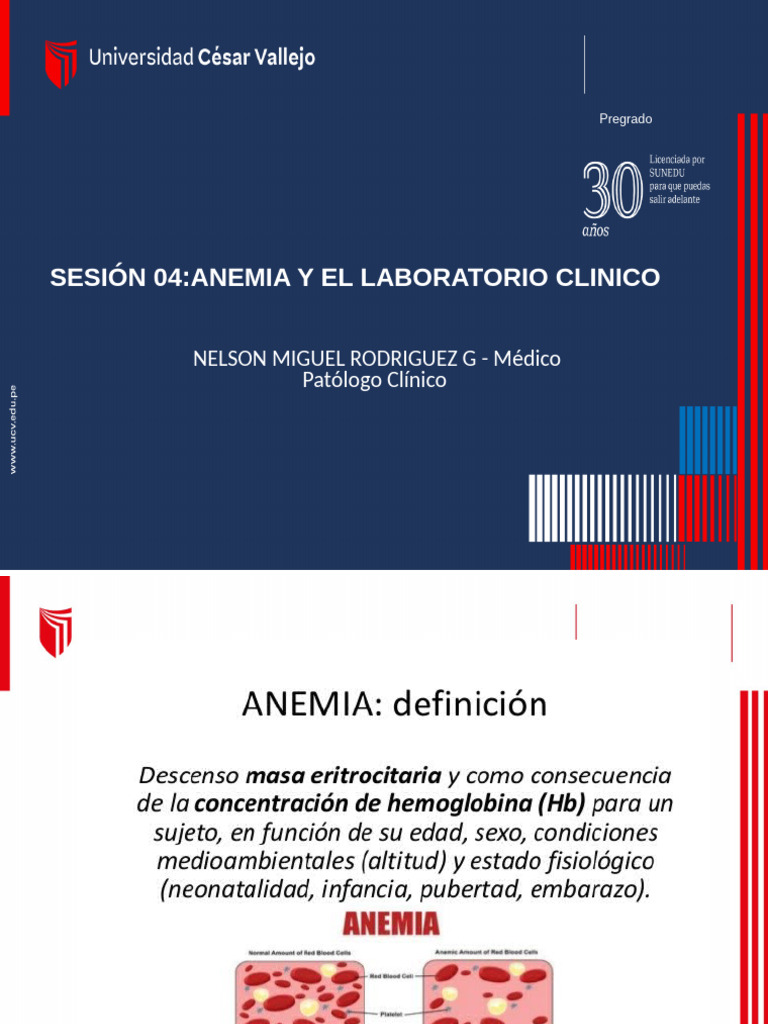 Anemia y Diagnóstico en Laboratorio Clínico | PDF | Anemia | Tejido ...