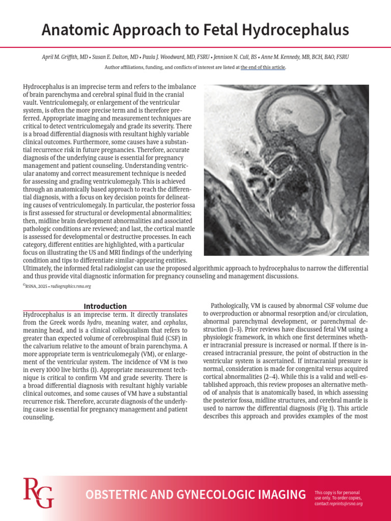 Anatomic-Approach-To-Fetal-Hydrocephalus RSNA | PDF | Corpus Callosum ...