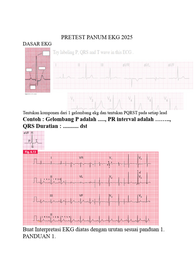 Pretest Panum Ekg 2025 | PDF