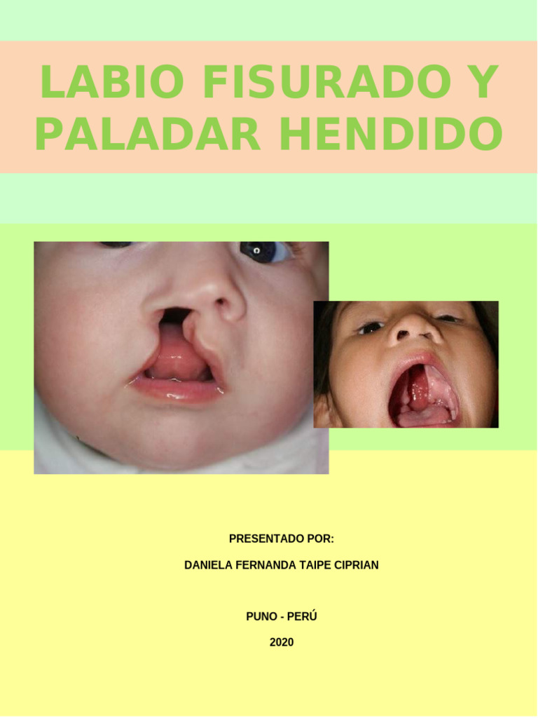 Monografa Labio Fisurado y Paladar Hendido | PDF