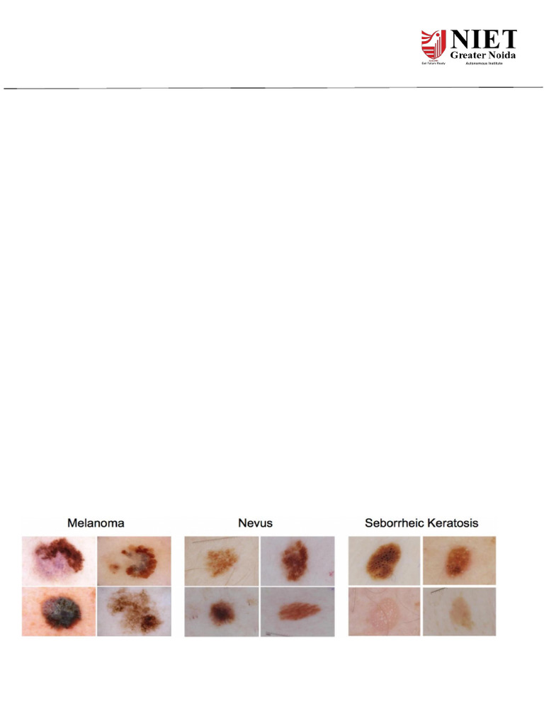 Research Paper On Skin Cancer | PDF | Melanoma | Deep Learning