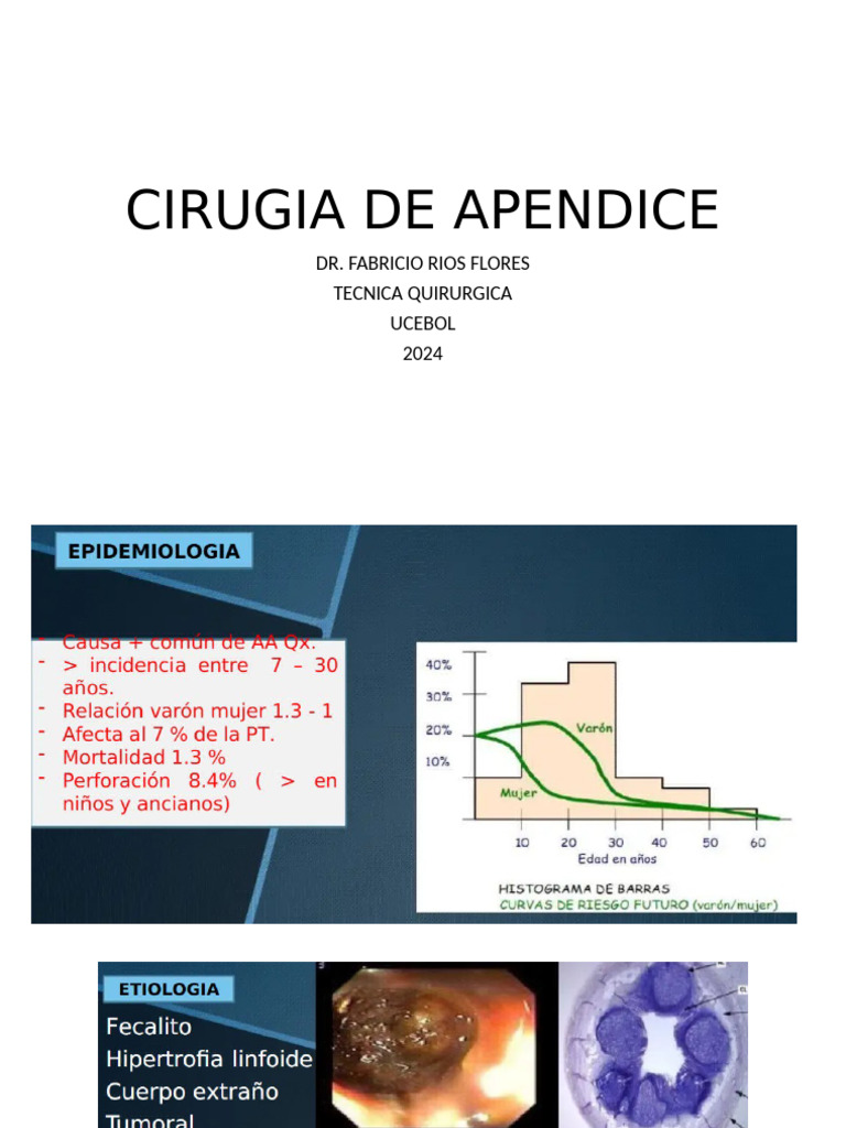 Cirugia de Apendice | PDF