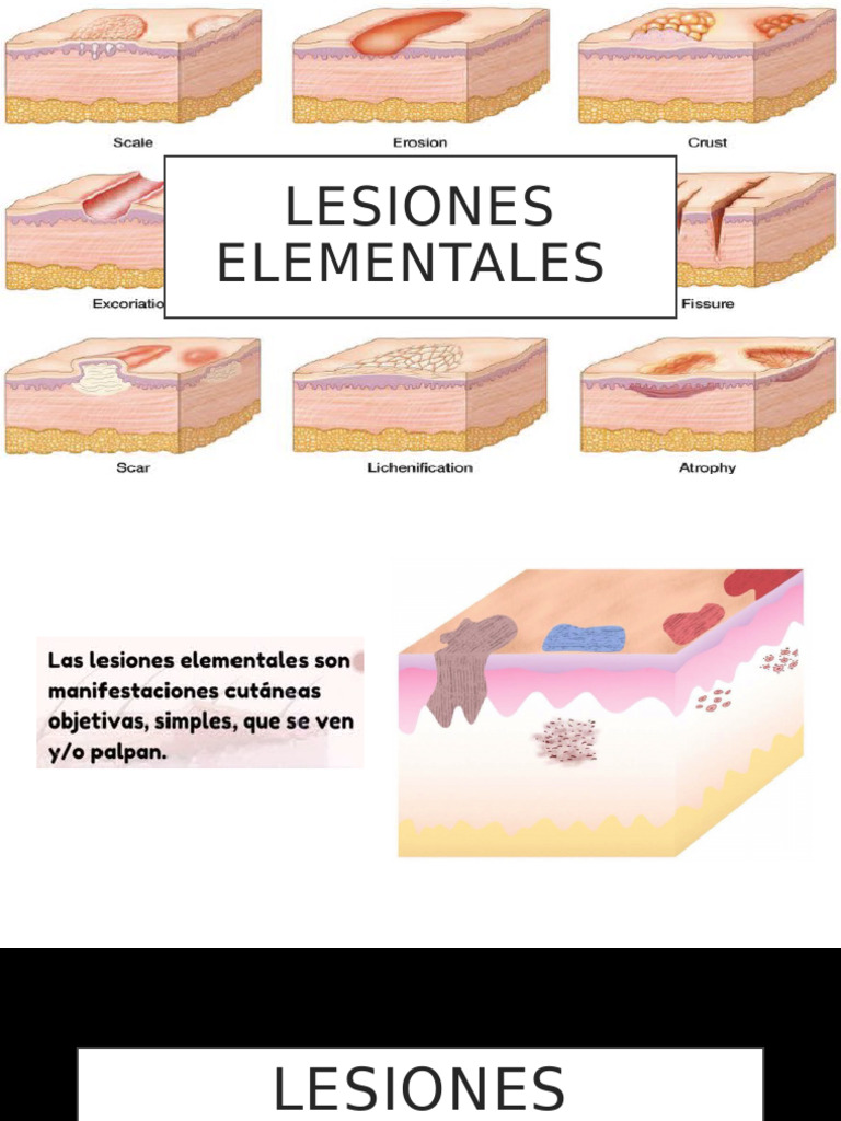 Ejemplos del fenómeno de Koebner | PDF | Piel | Morfología (biología)