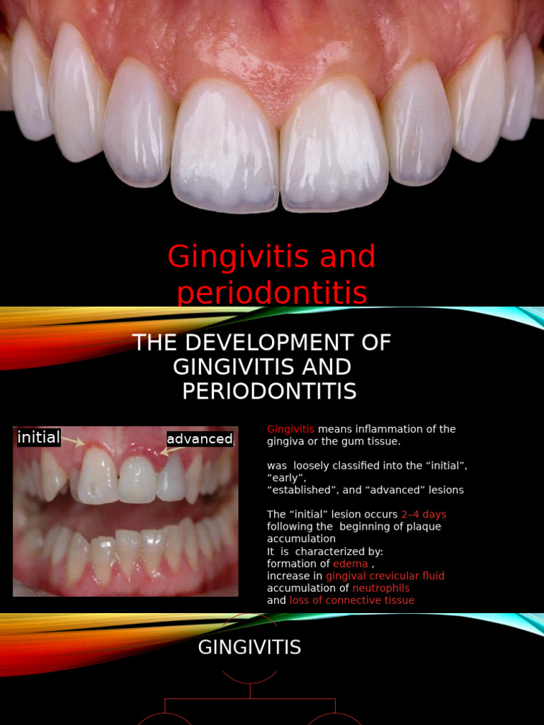 Presentation 5 | PDF | Periodontology | Dentistry