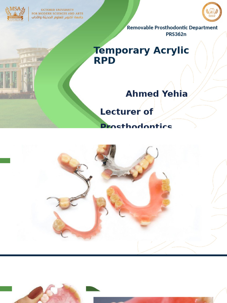 11-Temporary Acrylic RPDs | PDF | Dentures | Medical Specialties