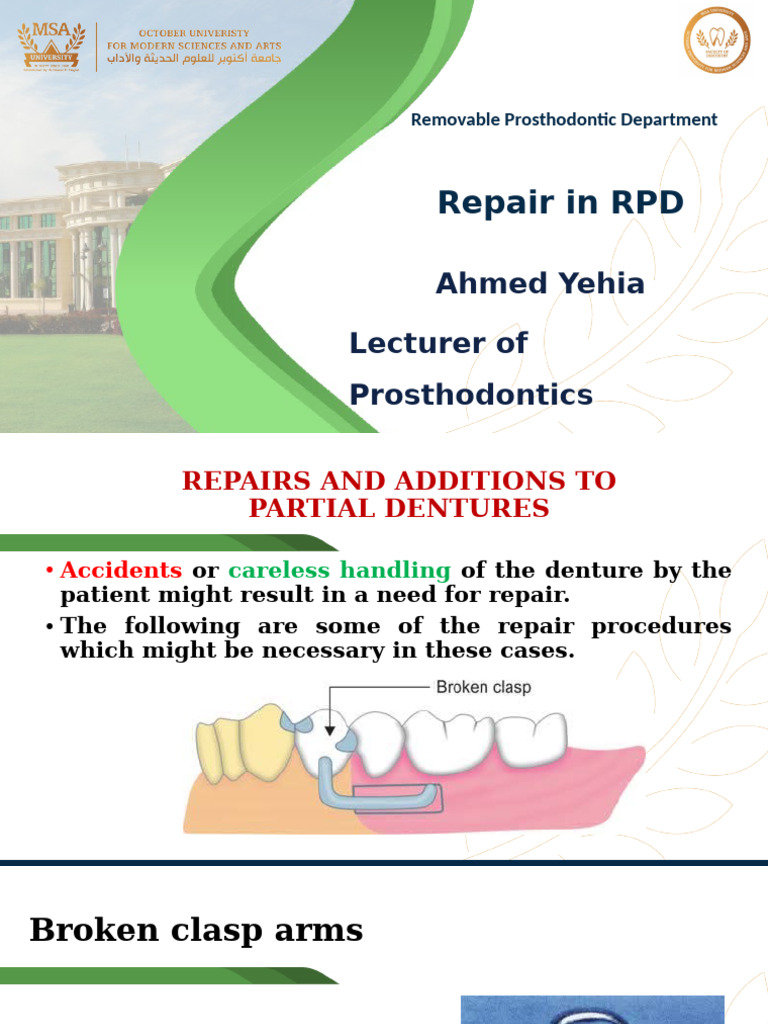 12-Repair and Addition of Partial Denture | PDF | Dentures | Dentistry ...