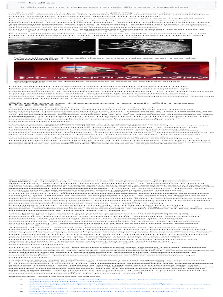 Síndrome Hepatorrenal (SHR) o Que É e Tudo Sobre A Cirrose Hepática - Sanar Medicina | PDF ...