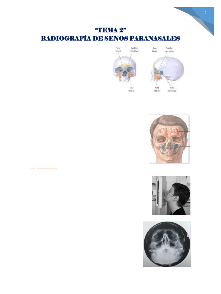 Quiste en senos paranasales: Radiografía | PDF | Nariz humana | Cráneo