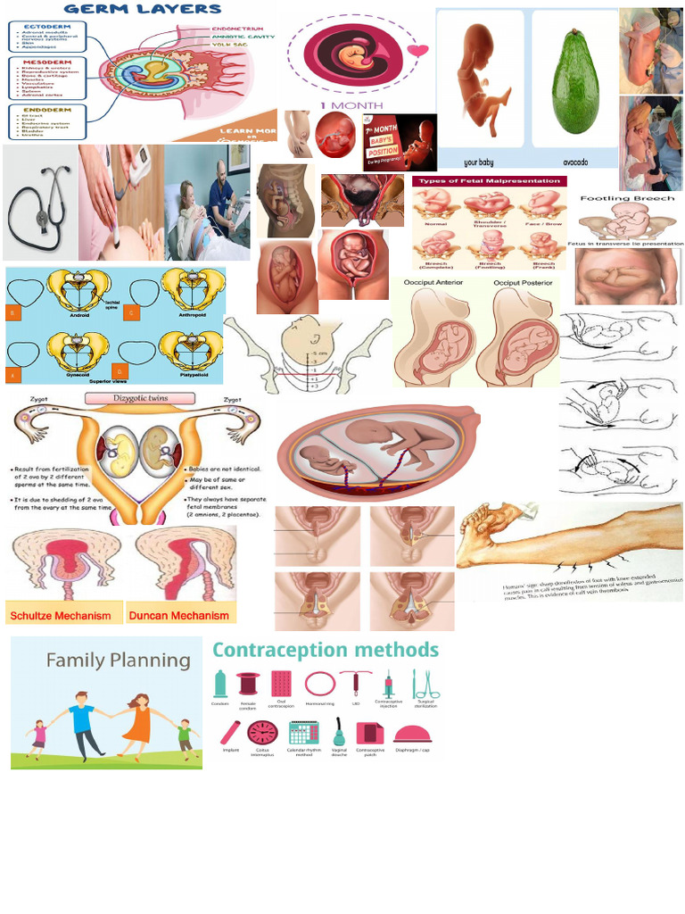 ob finals pics | PDF