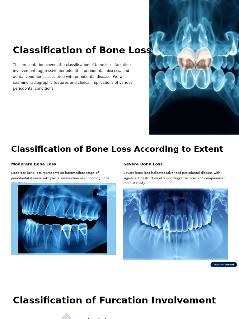 Classification of Bone Loss | PDF | Periodontology | Human Tooth