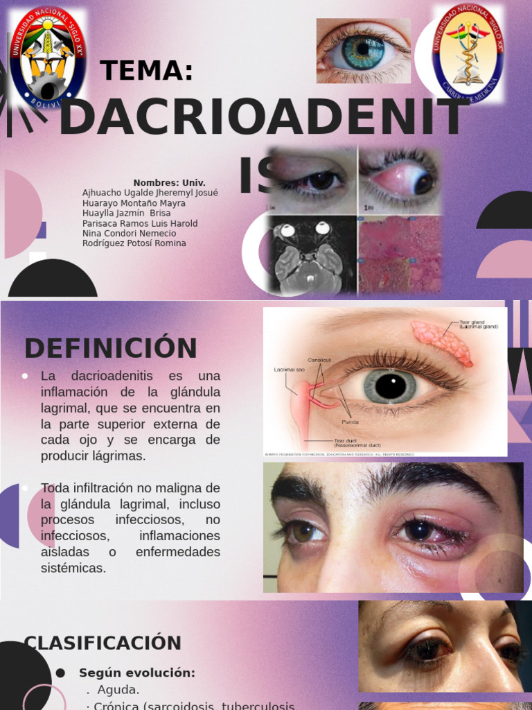Dacrioadenitis Oficial | PDF | Inflamación | Medicina