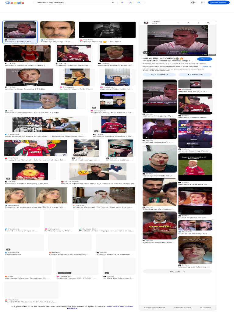 Anthony Foto Mewing - Buscar Con Google | PDF | Software iOS | Software ...