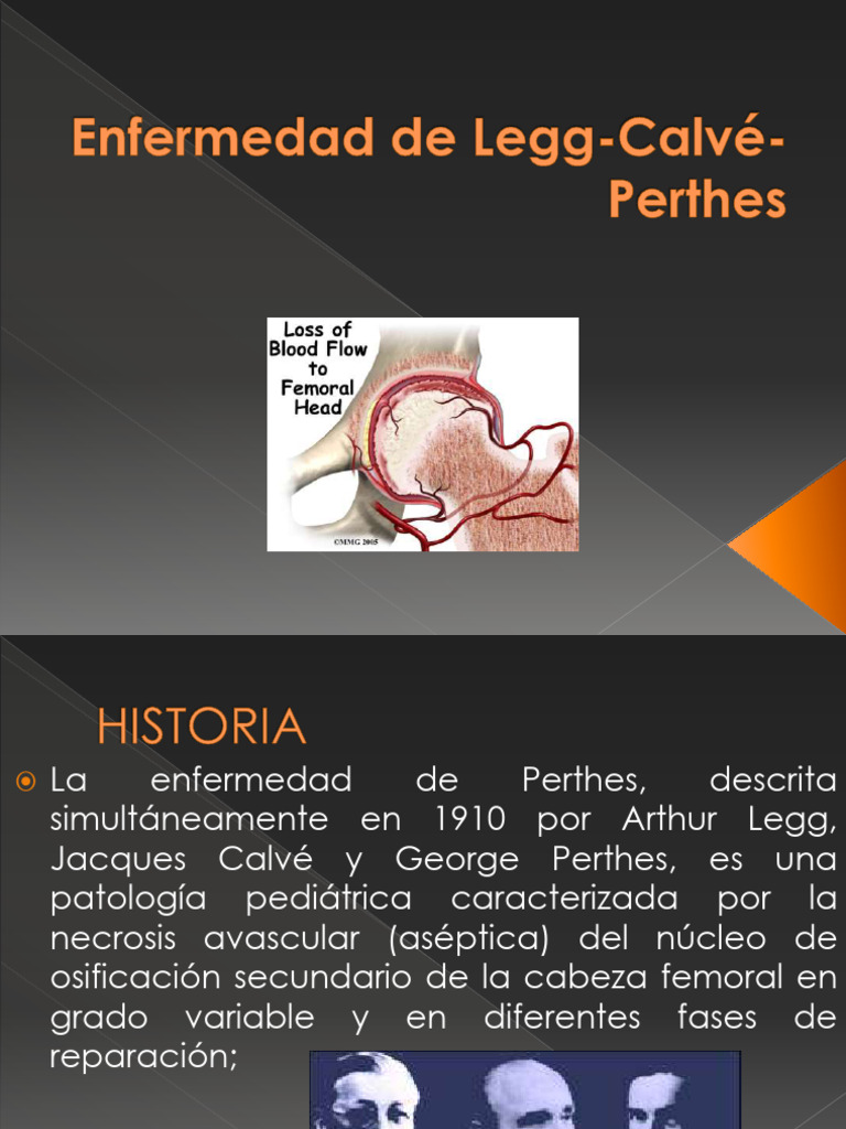 Enfermedaddelegg Calv Perthes 120523054323 Phpapp01 | PDF | Hueso | Rodilla