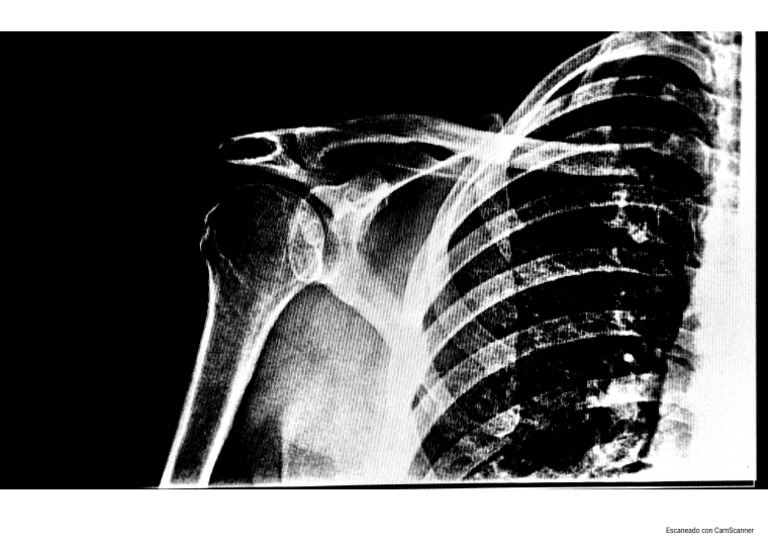 rx hombro JM 15-04-2025 09.24 | PDF